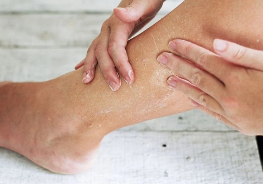 Da body khô nên dùng gì? Top những sản phẩm dưỡng da body tốt nhất hiện nay